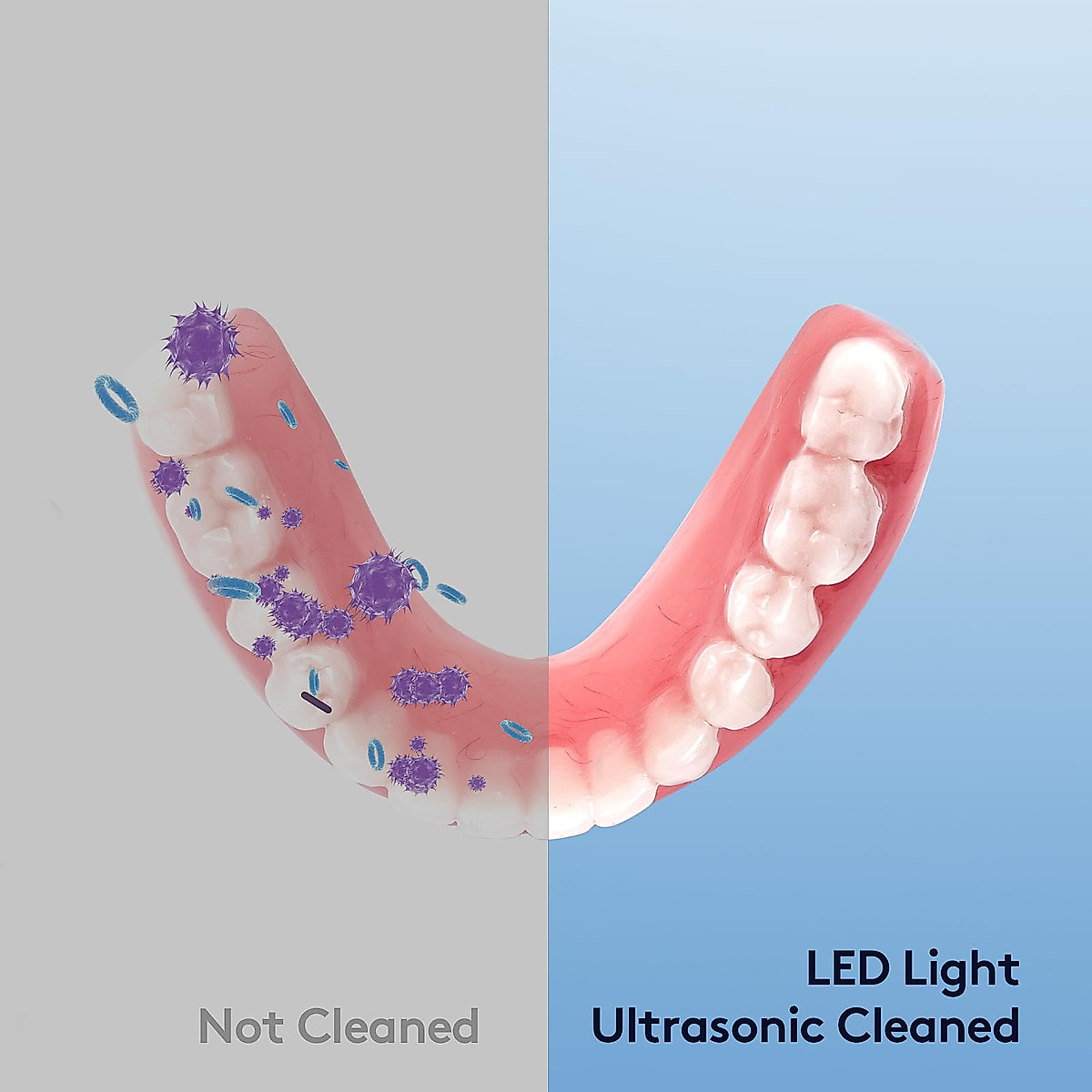 Ultrasonic U-V Cleaner for Dentures, Retainer, Mouth Guard, Aligner, Whitening Trays, Toothbrush Head, 45kHz Ultrasonic Retainer Cleaner Machine for All Dental Appliances, Jewelry, Diamonds