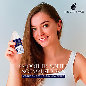 Silicone Scar Cream with Medical Grade Silicone Stretch Mark Cream Treatment - Formula Scar Gel Works for C-Section, Stretch Marks, Keloid, Acne - Surgical Scars Effective, Old and New Scars - 30g