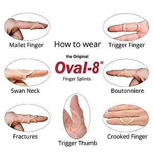 3-Point Products Oval-8 Finger Splints, The Original Finger Splint for Support and Protection for Arthritis, Trigger Finger or Thumb, and Other Finger Conditions,