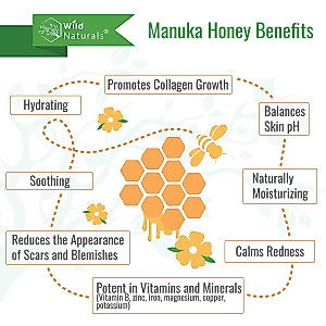 Natural Manuka Honey Eczema & Psoriasis Conditioner - Soothing Moisturizer for Scalp - Sulfate-Free Dandruff Relief with Aloe Vera - Ideal for Oily Hair - Nourishes Hair Growth with Coconut Oil