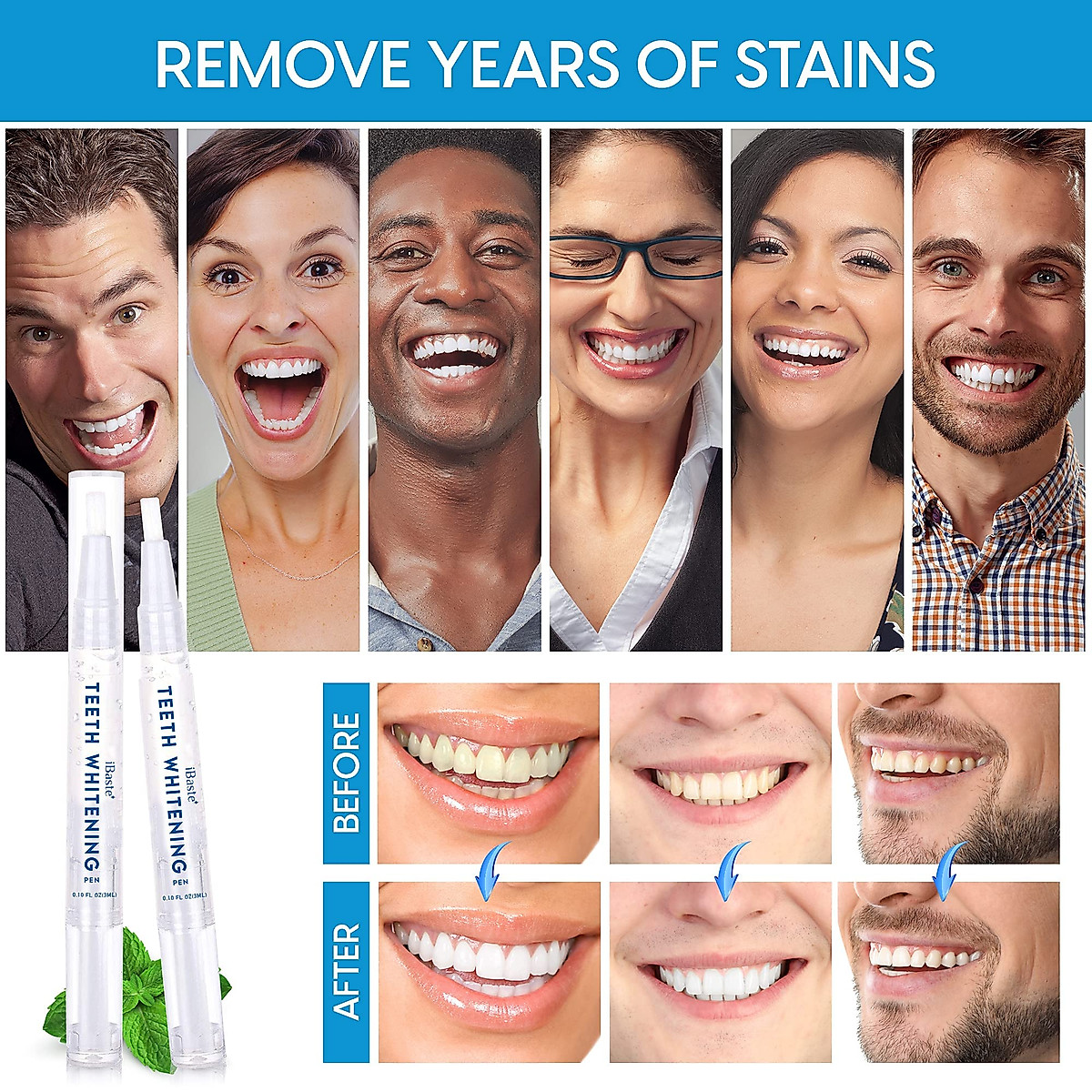 Teeth Whitening Pen - 3 Pens, 35% Carbamide Peroxide, Effective & Painless Whitening, Perfect for Sensitive Teeth, No Sensitivity, Travel-Friendly, Natural Mint Ingredient