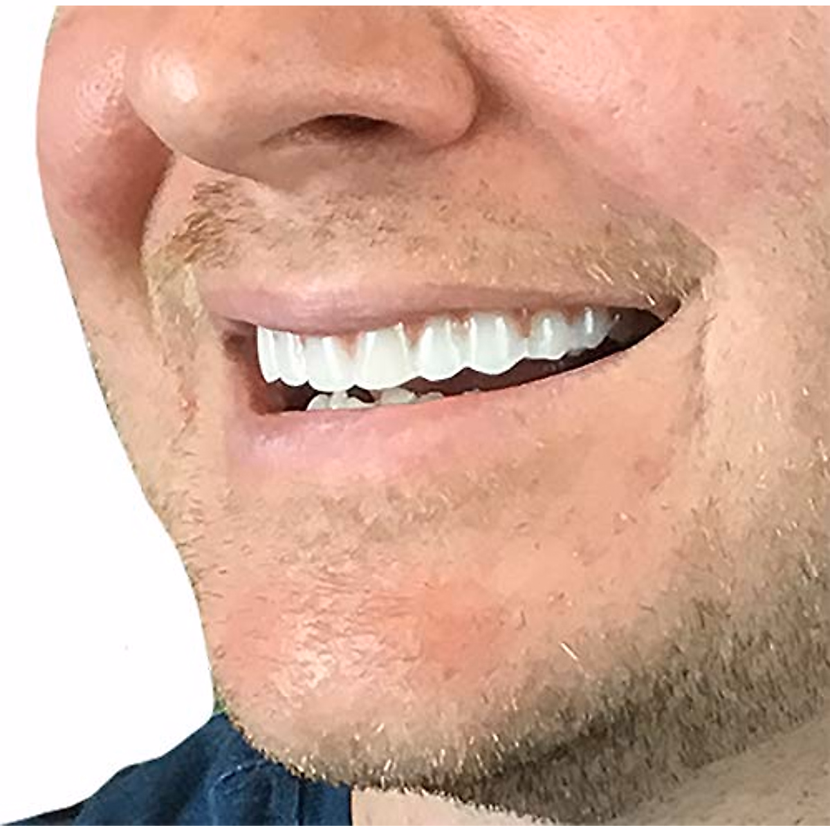 Instant Smile Comfort Fit Flex - Natural Shade - Upper Veneer Cosmetic Teeth