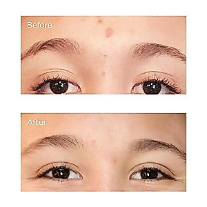 Perricone MD Acne Relief Prebiotic Acne Therapy