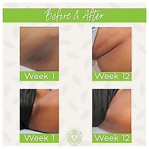 Amaira Skincare Intimate Natural Brightening Serum - Kojic Acid Dark Spot Corrector - Formulated for Sensitive Skin and Private Areas - Natural Plant-Based Formula (1.7 fl oz)