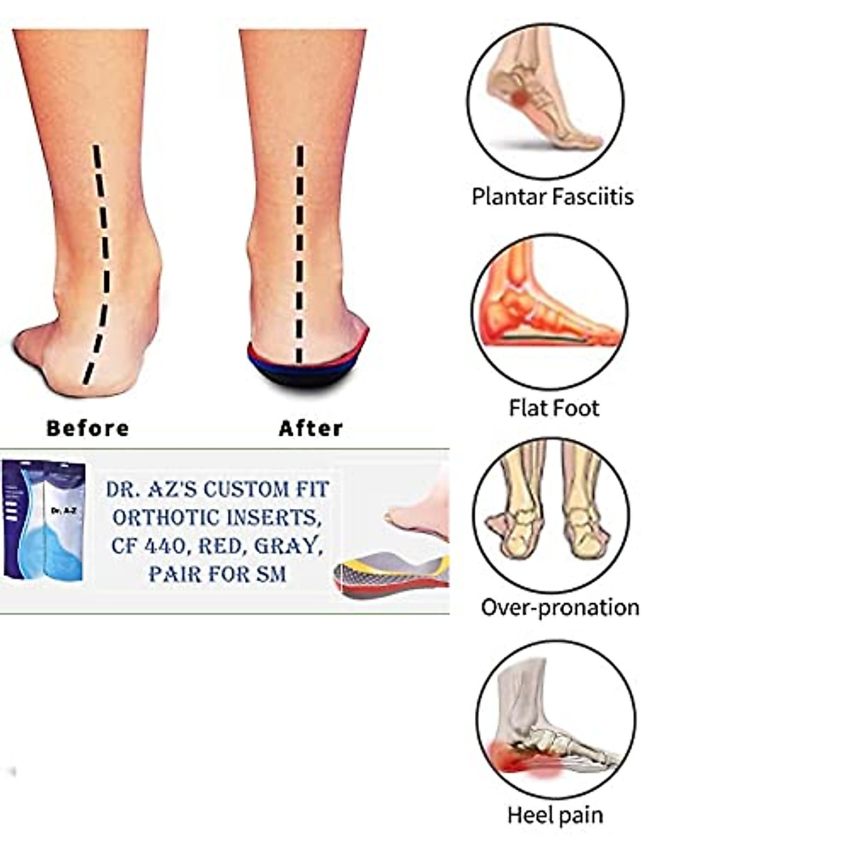 Rewind With Nature Arch Support Insoles for Men and Women, Orthotic Shoe Insoles, High Arch Support, Plantar Fasciitis Relief, Heel Pain, Overpronation, Flat Feet