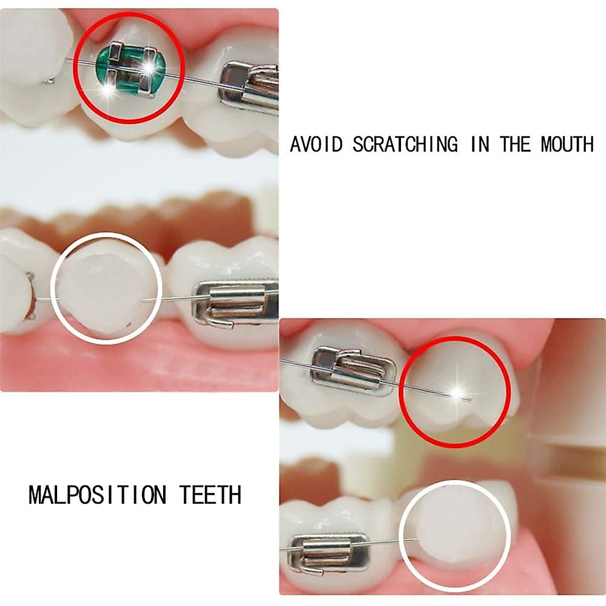 RZJZGZ Dental Oral Care Orthodontics Wax with Fruit Smell for Brace Wearers Flavored Gum Protection (3Pack)