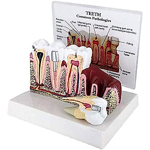 KEZaiZHe Anatomy Education Model - Teeth Cross-Section Model - Gums Model Anatomy Teeth Model Detachable Education Dental Model - for Study Display Teaching Medical Model