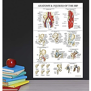 Palace Learning Laminated Anatomy and Injuries of the Hip Poster - Hip Joint Anatomical Chart - 18" x 24"