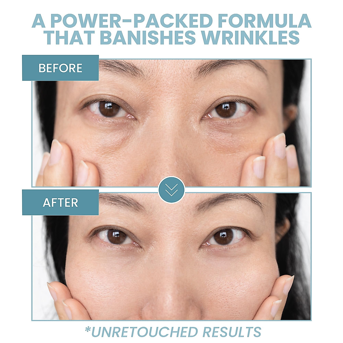 Anti-Aging Eye Gel - Luxurious Hydrating Under Eye Cream For Dark Circles and Puffiness, Bags, Crows Feet, Wrinkles - With Hyaluronic Acid & Skin-Firming Peptides Eye Serum (2 oz.)