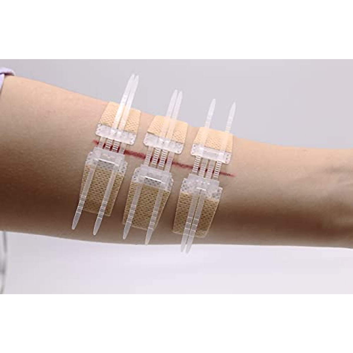 Israeli First Aid Emergency Laceration Closure Kit for Lacerations and Cuts, 10 Piece Set