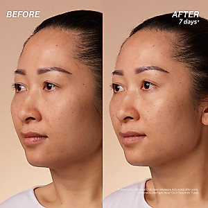 L'OCCITANE Immortelle Overnight Reset Oil-In-Serum: More Radiant Skin In 1 Night, Smooth Fine Lines, Revitalize Dull Skin, Award-Winner, With Immortelle Essential Oil, 1.6 Fl. Oz