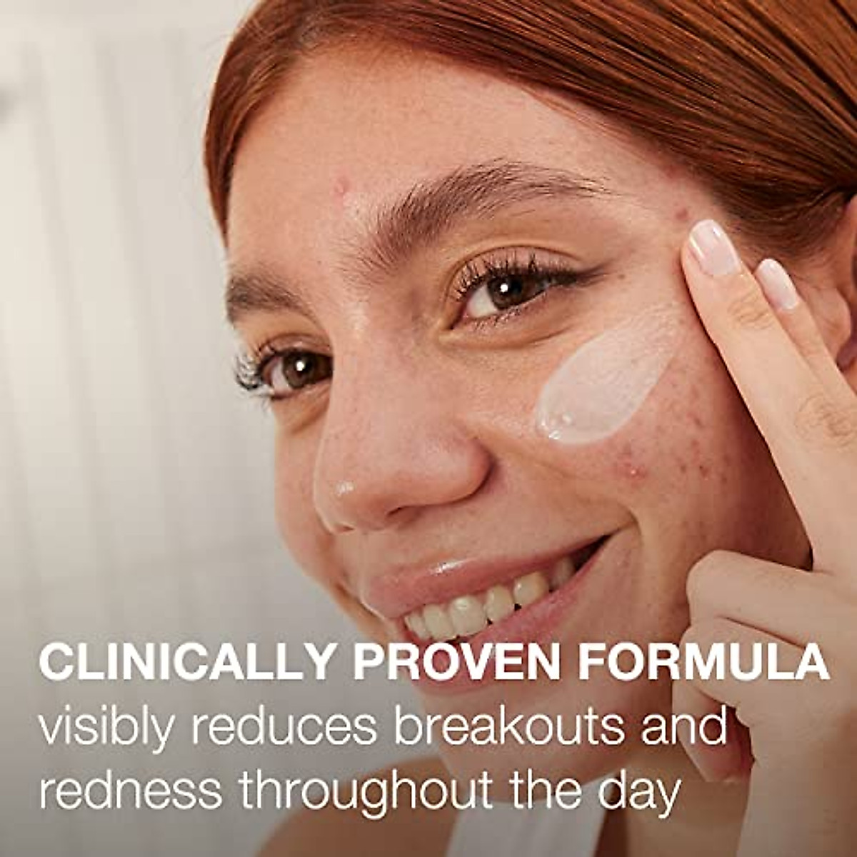 Neutrogena Stubborn Acne AM Face Treatment with 2.5% Micronized Benzoyl Peroxide Acne Medicine, Oil-Free Daily Facial Treatment to Reduce Size & Redness of Breakouts, Paraben-Free, 2 oz