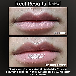 Revision Skincare YouthFull Lip Replenisher, the definitive solution for youthful lips, 0.33 oz
