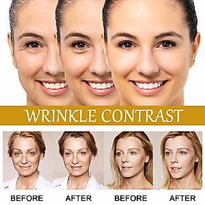 Vintesse Advanced Bee Venom Serum, Vintesse Bee Serum, Vintesse Serum, Vintesse Bee Venom Serum (1PCS)