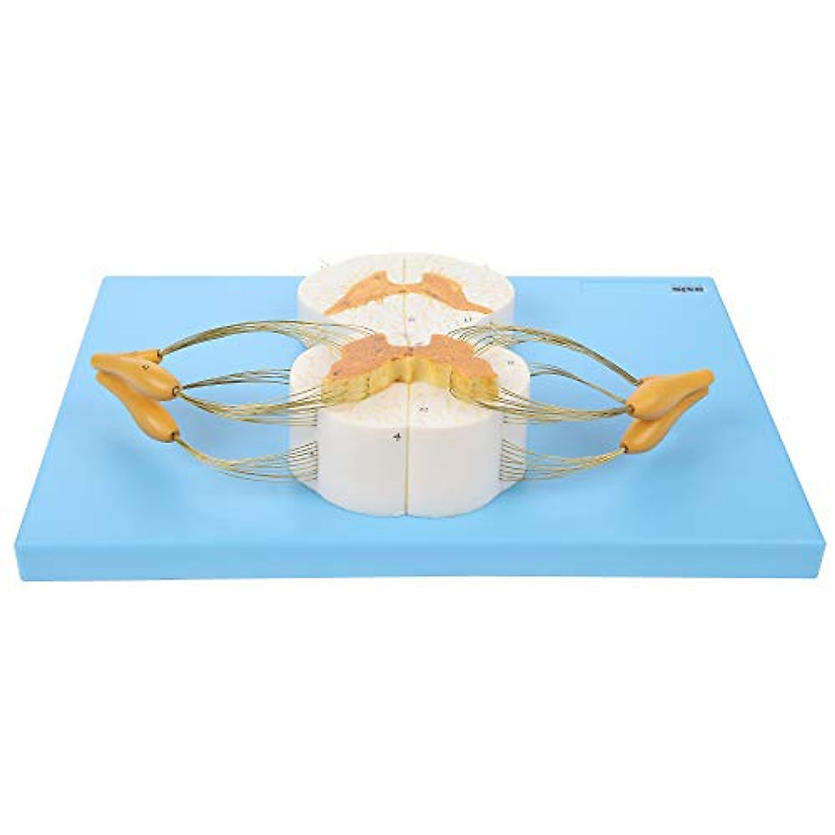 Axis Scientific Enlarged Spinal Cord Model, 8X Life Size Nerves Plus Anterior and Posterior Nerve Roots and Spinal Ganglion - Includes Product Manual, and Base for Display