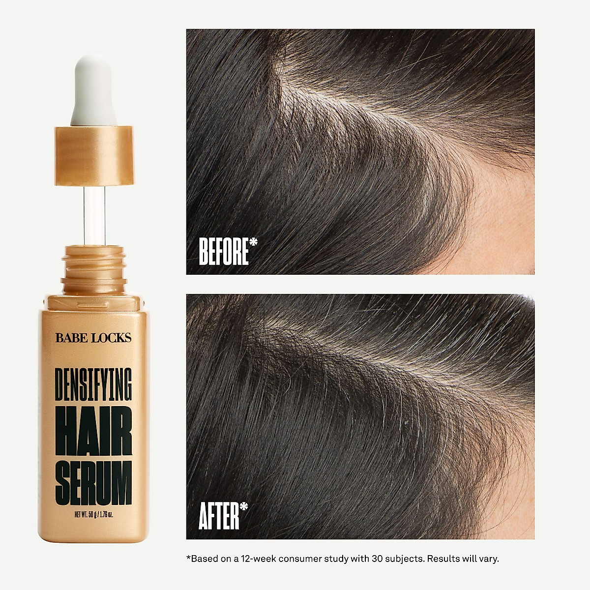 Babe Original Locks Densifying Hair Serum for Men and Women, Promotes Thickness in Thinning Hair & Hair Loss