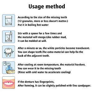 F.ZENI Teeth Repair Kit, Temporary Teeth Replacement Kit, Do it Yourself Thermal Fitting Beads, Moldable False Teeth for Snap On Instant and Confident Smile