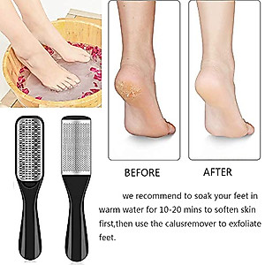 36 in 1 Pedicure Kit, Professional Pedicure Tools Foot Rasp Foot Dead Skin Remover for Home & Salon Care
