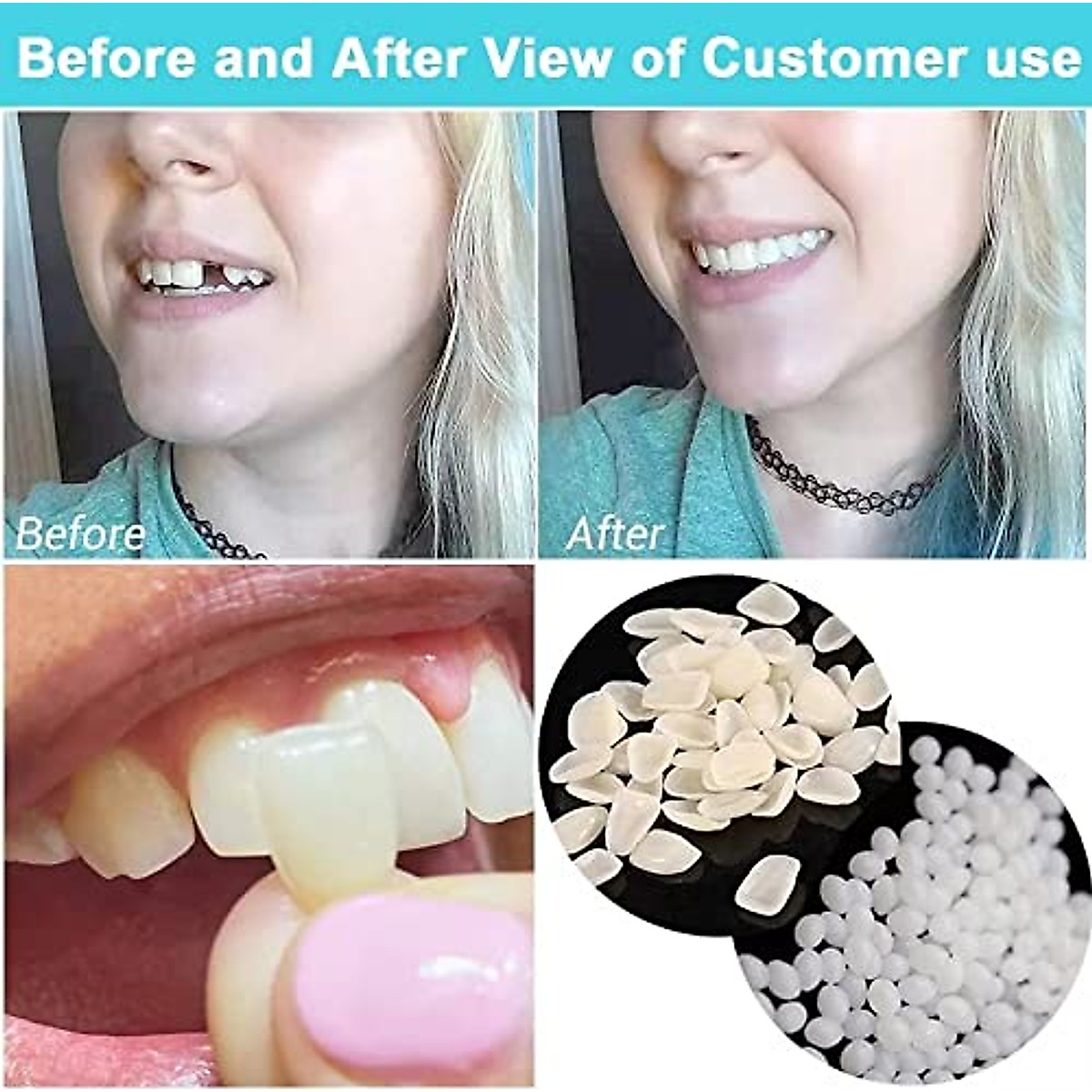 Tempoary Tooth Repair Kits DIY Dental Care Kit Glue for Filling Missing Broken Teeth Crowns and Bridges Moldable Fake Teeth to Regain Your Beautiful Smile in Minutes-White Color
