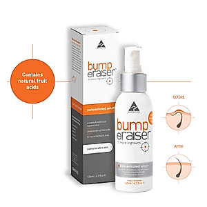 Bump Eraiser Concentrated Ingrown Hair Serum 4.2 fl oz for Ingrown Hair Treatment, Razor Burns and Razor Bumps