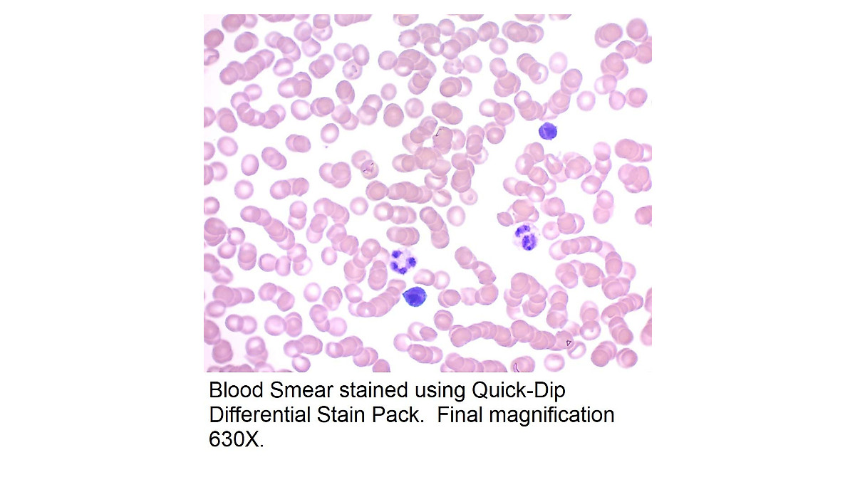 Quick-Dip Differential Stain Pack - Stain Blood Smears Quickly
