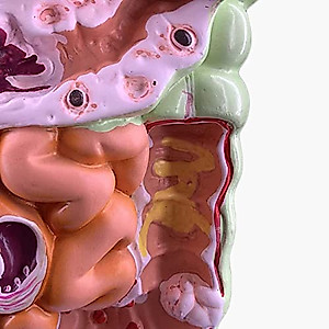 HEYBEC Model of Human Gastrointestinal Anatomy,Model of The Human System, Colon Disease Model, Structure of The Internal Organs for Teaching in Medical Displays
