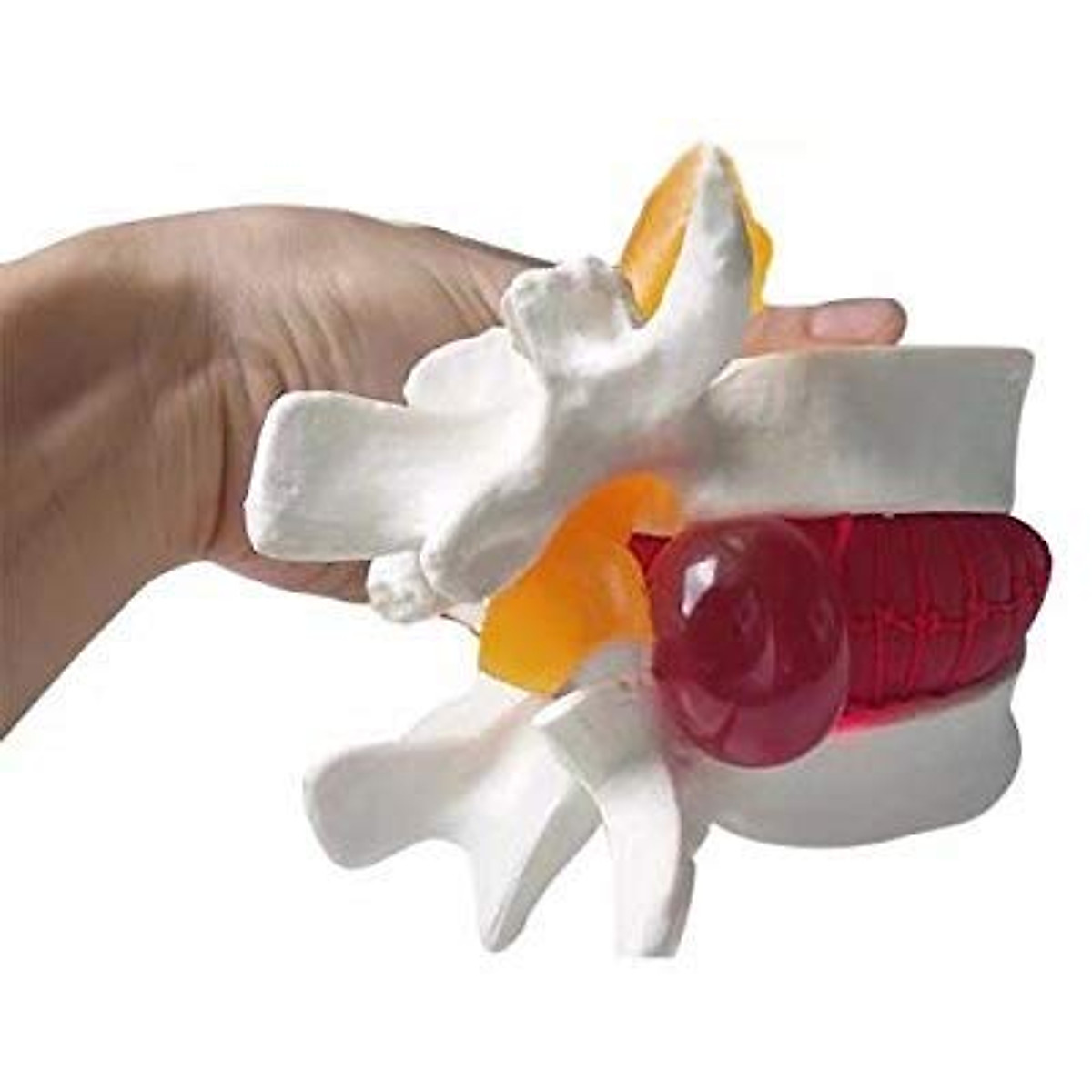Doc.Royal Anatomical Human Lumbar Vertebrae Degenerative Lumbar Human Spine Model 1PCS