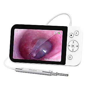 LIUJIAN Otoscope with 5 Inches Screen, 3.9mm Ear Camera with 6 LED Lights, 32GB Card, Ear Wax Removal Tool, Specula and 2500 mAh Rechargeable Battery, Supports Photo Snap and Video Recording