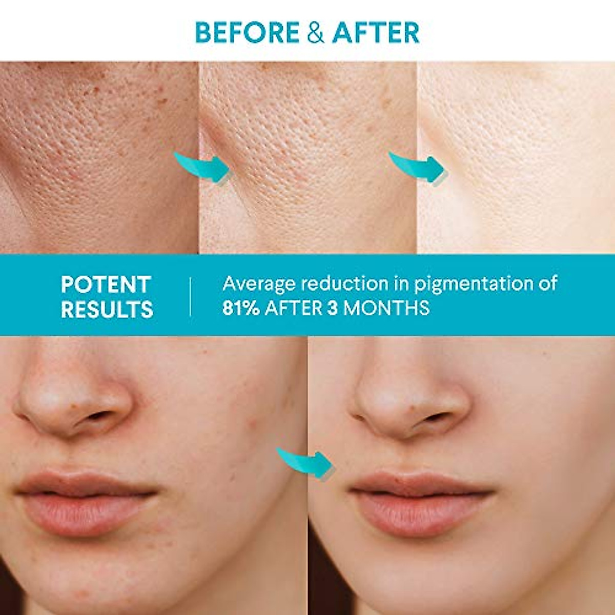 Rejopes Dark Spot Corrector Remover for Face and Body, Dark Spot Remover with Natural Ingredients,1.7 Fl Oz