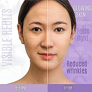 DERMAXGEN Lift And Firm 30% Peptide Serum - Matrixyl 3000, Vitamin C & E + Hyaluronic Acid + Aloe Vera | Collagen Booster, Skin Tightening & Anti-aging Formula - (8 FL OZ) For All Skin Types