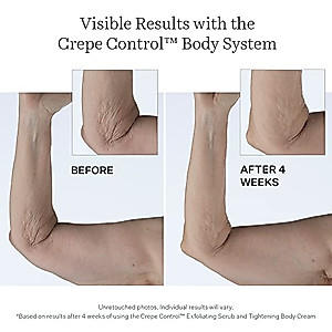 StriVectin Tighten & Lift Crepe Control Tightening Body Cream for Firmer, Brighter Arms & Legs, 6.7 Fl Oz