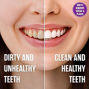 SprinJene Natural SLS Free Sensitive Toothpaste for Cavity Protection & Sensitive Teeth & Gum with Fluoride Fresh Breath Helps Dry Mouth 1 Pack (Improved)