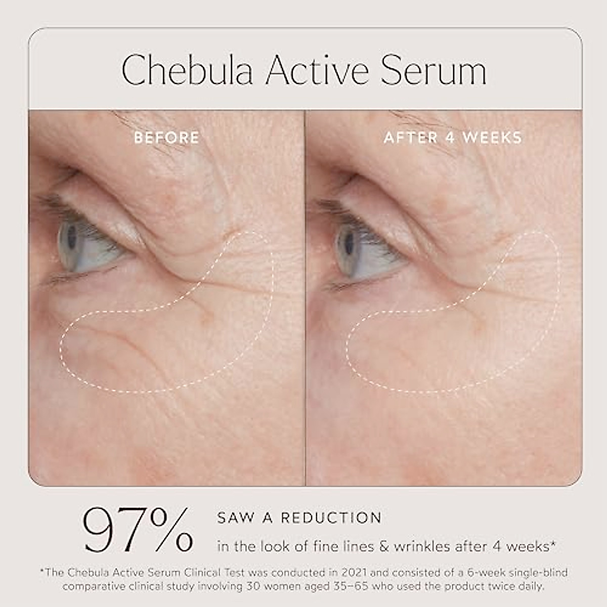 True Botanicals Chebula Active Serum | Optimizes Skins Collagen Levels | Anti-Aging Serum | Treats Fine Lines & Wrinkles | All Skin Types | Dermatologist Tested, All Natural, Vegan | 1 fl oz | 30 ml