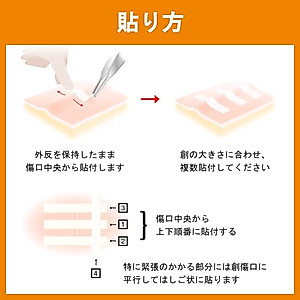 Minnesota 3M Healthcare Steri-Strip 1/4" x 4", Reinforced Category: Specialty Dressings Woundcare Products (10 Strips)