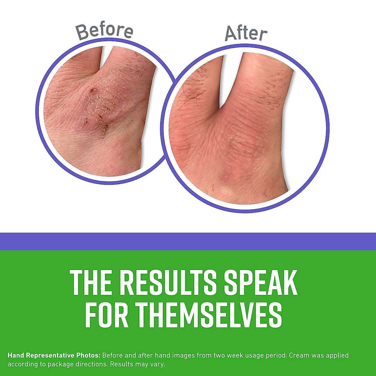 O'Keeffe's Night Treatment Combo Pack Including Working Hands Night Treatment Hand Cream, Healthy Feet Night Treatment Foot Cream and Lip Repair Night Treatment Lip Balm