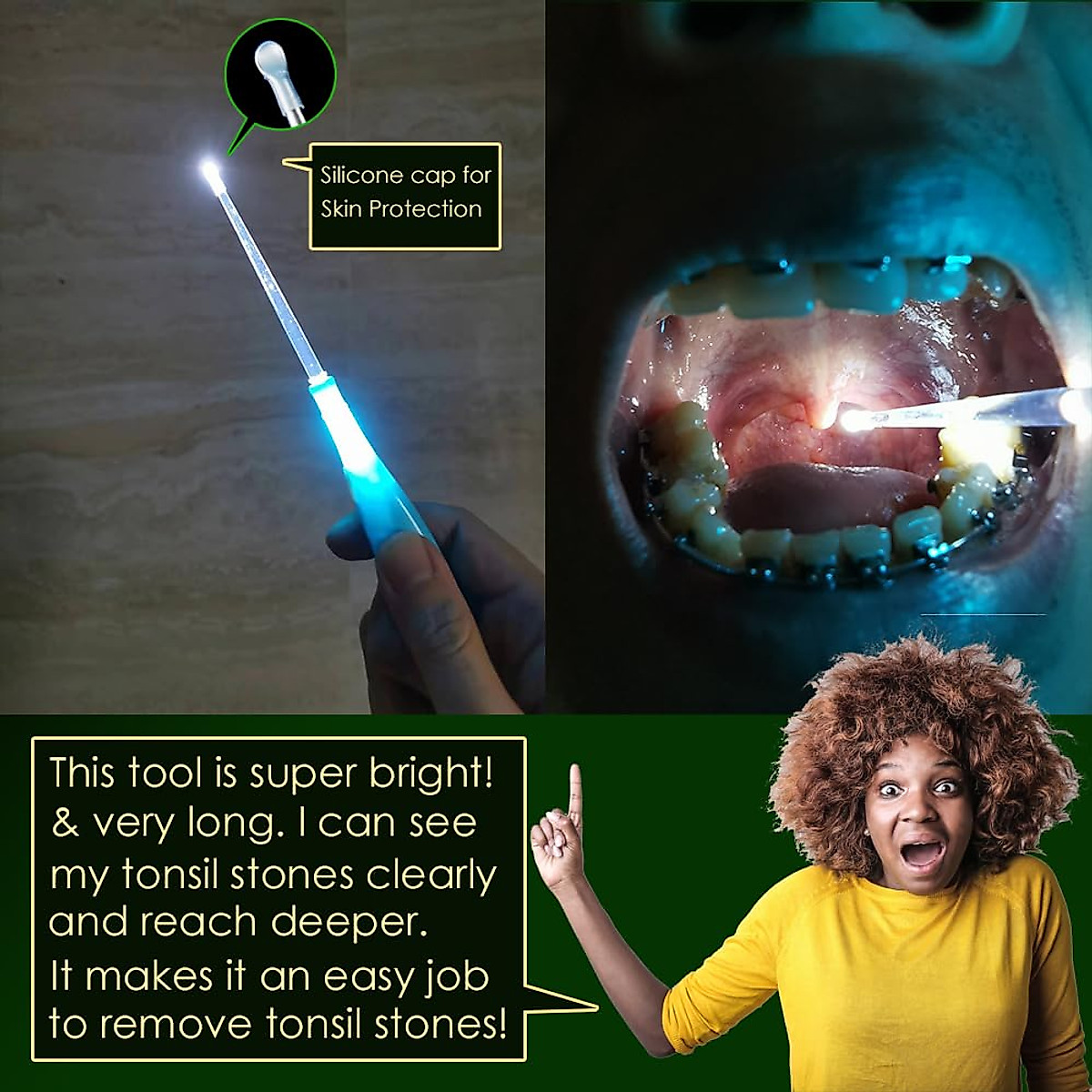 Airgoesin Upgraded 2 Lighted Tonsil Stone Remove Tool Tonsillolith Pick + Irrigation Clean Syringe Fresh Breath Oral Rinse