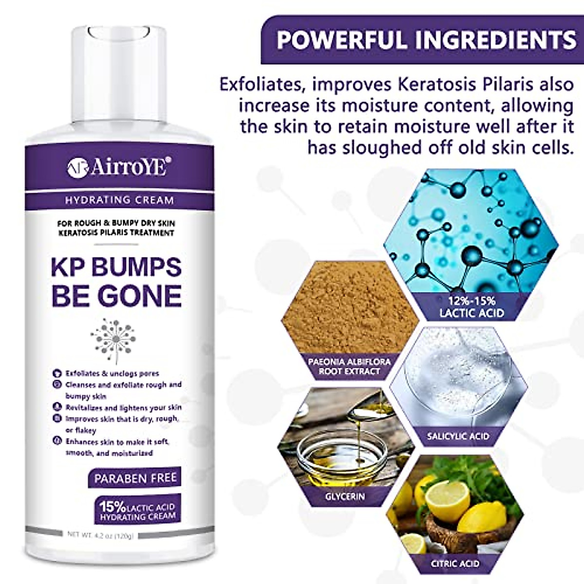 AirroYE Kp Bump Eraser, Keratosis Pilaris, KP Bumps Be Gone Hydrating Cream, Moisturizing Cream For Rough and Bumpy Dry Skin For Body, 4 Oz
