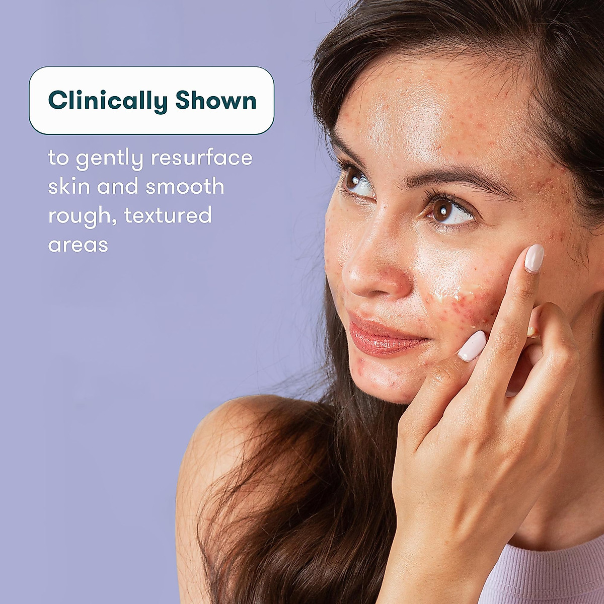 Proactiv Post Acne Scar Gel for Face with Antioxidants and vitamin E, Skin Smoothing Moisturizing - 1 oz.