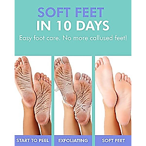 DERMAL KOREA Foot Peeling Mask 3 Pack For Dry Foot And Cracked Heel & Callus With Aloe Vera And Collagen - Exfoliating Peel Mask With Aha, Bha, & Pha And For Moisturizing, Soothing & Refreshing Feet