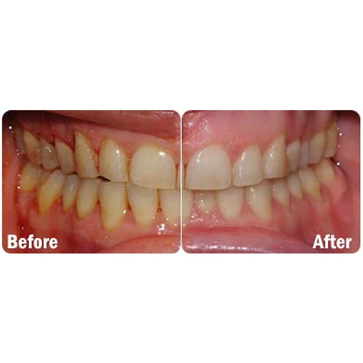 ProBiora Professional Strength Oral Probiotics for Teeth and Gums | Dental Probiotic for Oral Health | Bad Breath Treatment for Adults | Tooth Whitening | ProBiora3 Probiotic Blend | 90 Orange Tablets