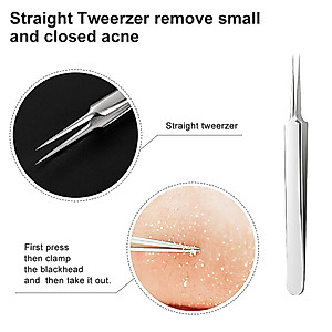 La Chat Blackhead Remover Kit - Blackhead Tweezers Removal Tool 3 pcs Comedone Pimple Extractor Tool, Acne Blemish Kit for Blackhead, pimple Tool, Curved Blackhead Tweezers kit (3 pcs)