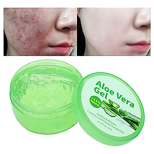 300g Gel Remove Pimples Shrink Pores After-Sun Repair Moisturizing Face Gel Skin Care, Prevent Skin Inflammation