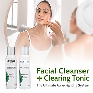 Exposed Skin Care Basic Acne Treatment Kit - Includes Salicylic Acid Face Wash, Clearing Tonic, Acne Treatment Serum with Benzoyl Peroxide, Clear Pore Serum - Acne Set Solution for All Skin Types