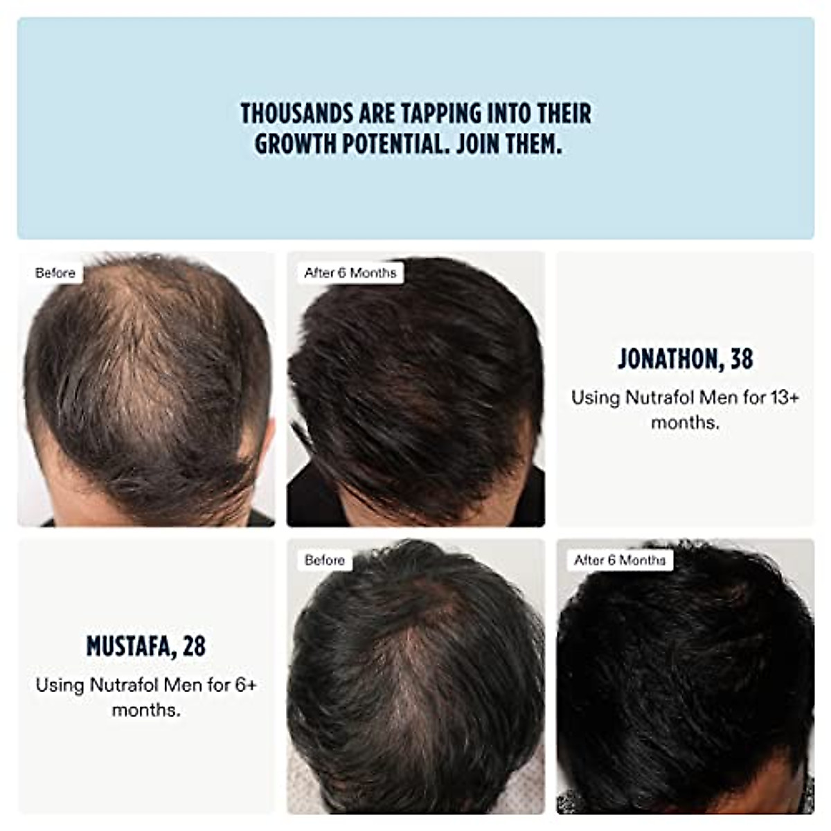 Nutrafol Men's Hair Growth Supplement | Clinically Effective for Visibly Thicker & Stronger Hair with More Scalp Coverage | Dermatologist Recommended | 1 Bottle | 1 Month Supply