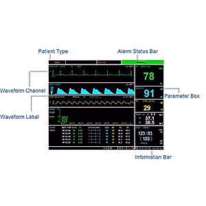 PM6000VCM 12" Veterinary Multi-Parameter Monitor with ETCO2(Mainstream) ECG RESP SpO2 NIBP Temp PR