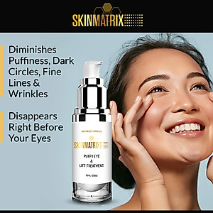 Puffy Eyes Treatment Serum- Anti Aging Under Eye Cream Formula for Puffiness, Dark Circles, Fine Lines, Wrinkles & Under Eye Bags with Hyaluronic Acid & Vitamin C. Instant Results within Minutes.