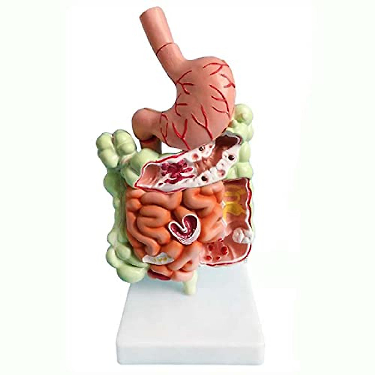 HEYBEC Model of Human Gastrointestinal Anatomy,Model of The Human System, Colon Disease Model, Structure of The Internal Organs for Teaching in Medical Displays