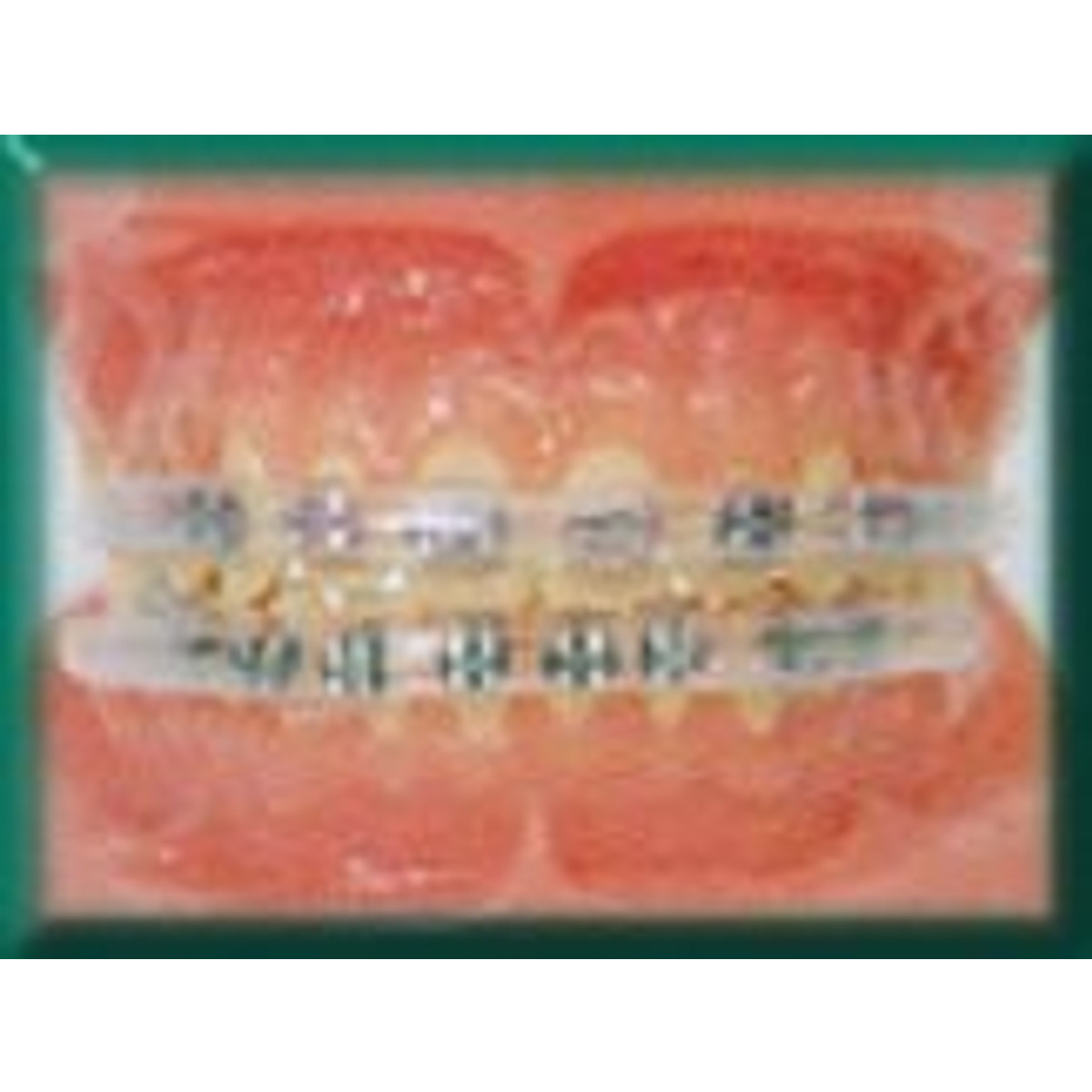 Morgan Bumper Braces Cover Lip Protector Qty 2 - Clear