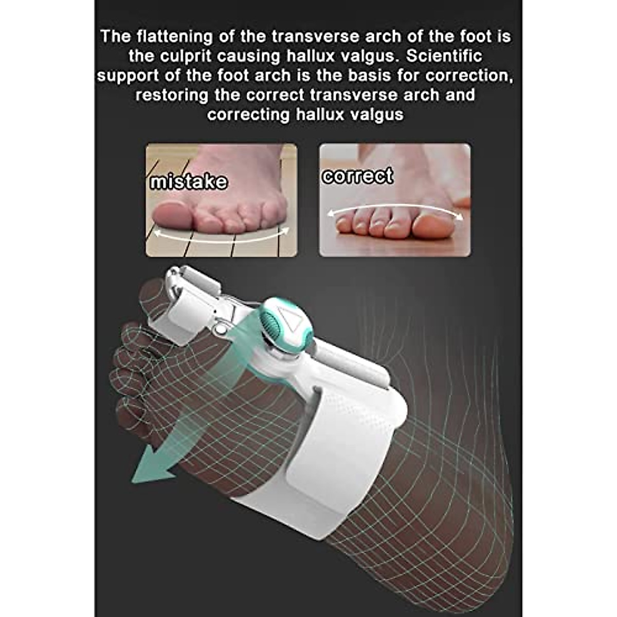 UGANI Hallux Valgus Corrector, Adjustable Bunion Splint with Silicone Inner Pad, Adjustable Bunion Splint for Bunion Relief with Knob Correction, Day Night Support