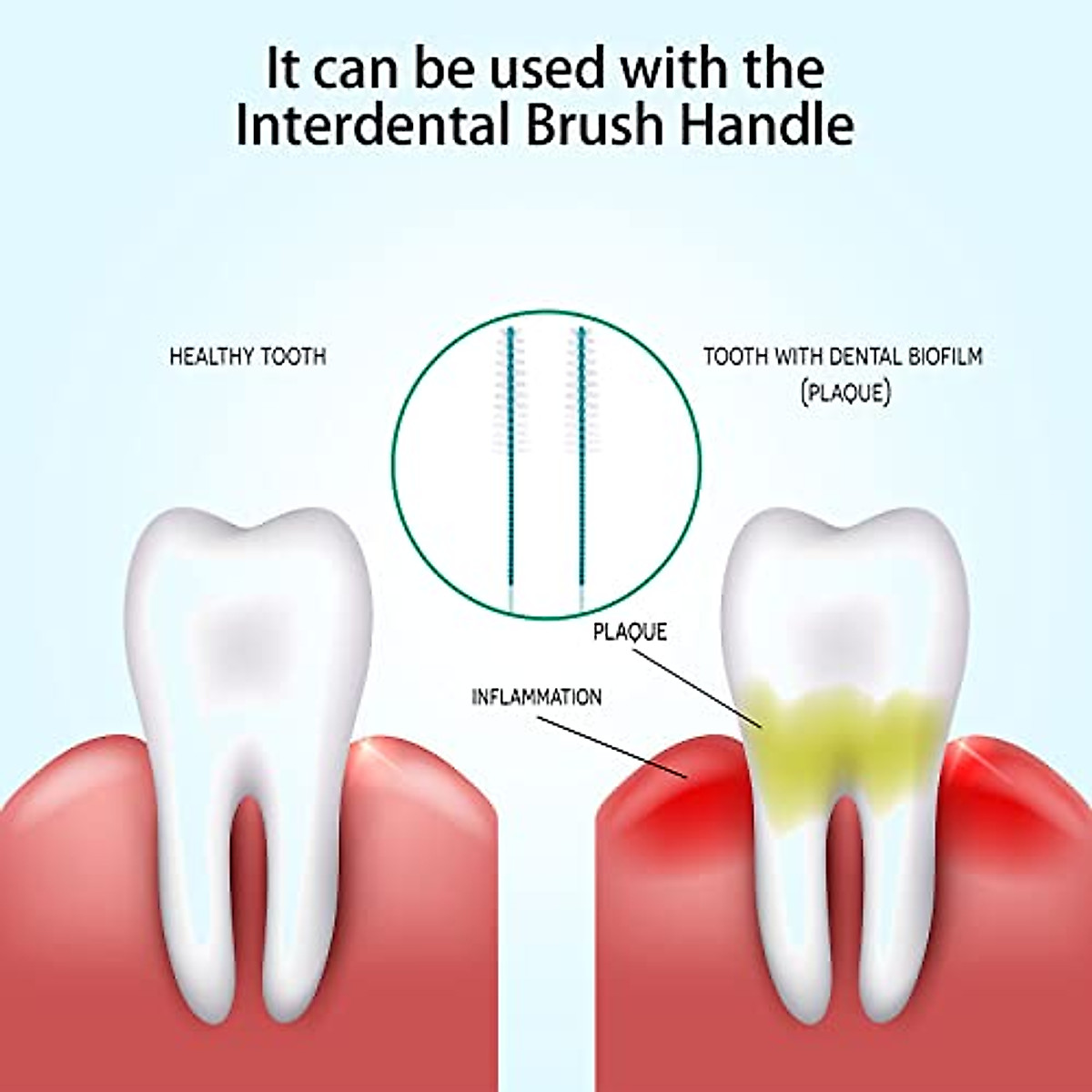 Cowwell Interdental Brush Teeth Soft Dental Picks Tooth Floss Interdental Brush Betweens Interdental Brush Refills White Refills for Tooth Cleaning (Tight, 100 Pieces)